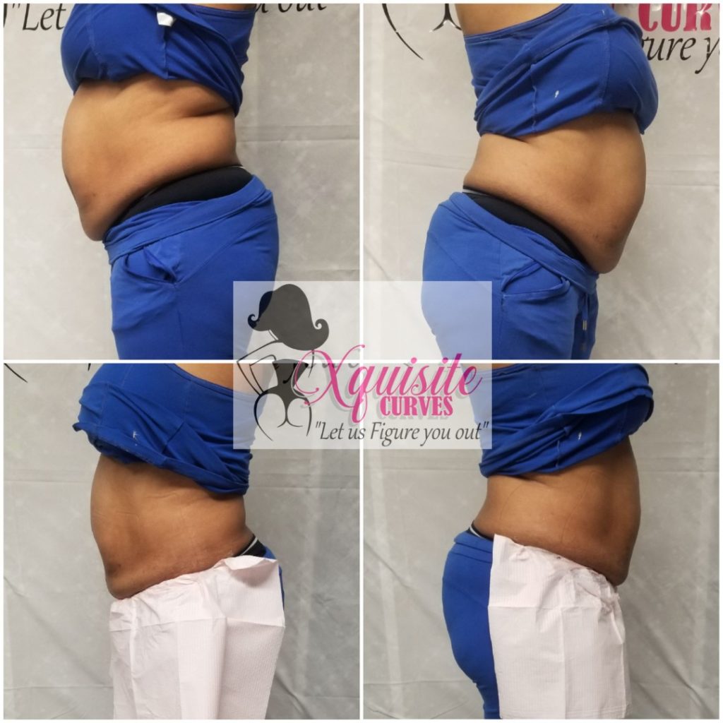 Xquisite Curves | Before/After